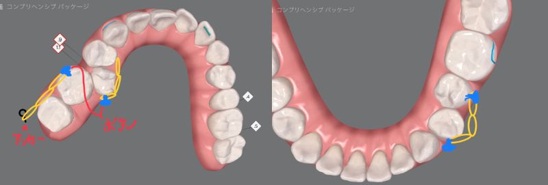 ボタン（会員） | D/NEX｜マウスピース矯正を実践的に学べる勉強グループ